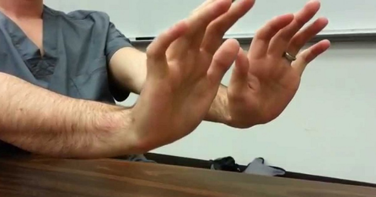 Asterixis: qué es, tipos, síntomas asociados y tratamiento