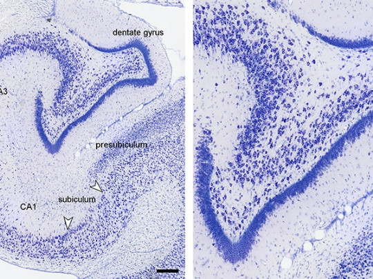 Subículo: partes y funciones de esta estructura cerebral