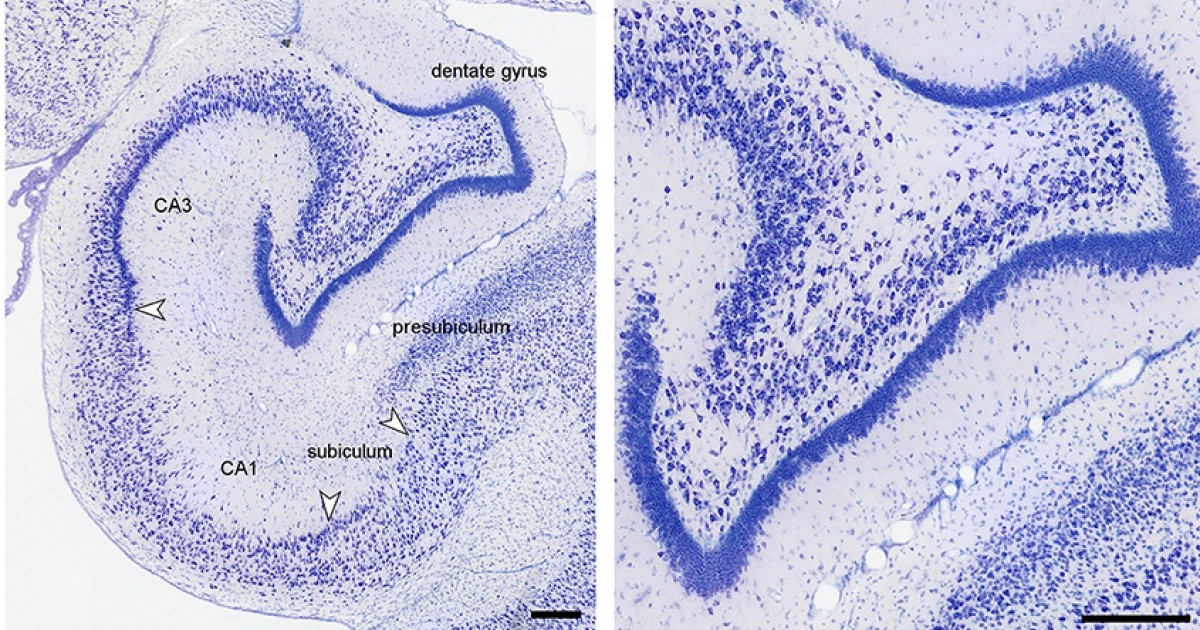 Giro dentado: qué es y qué funciones desempeña en el cerebro