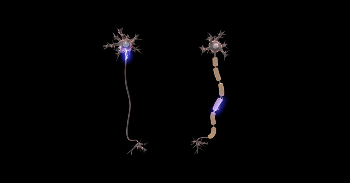 ¿Cuáles son las partes de la neurona?