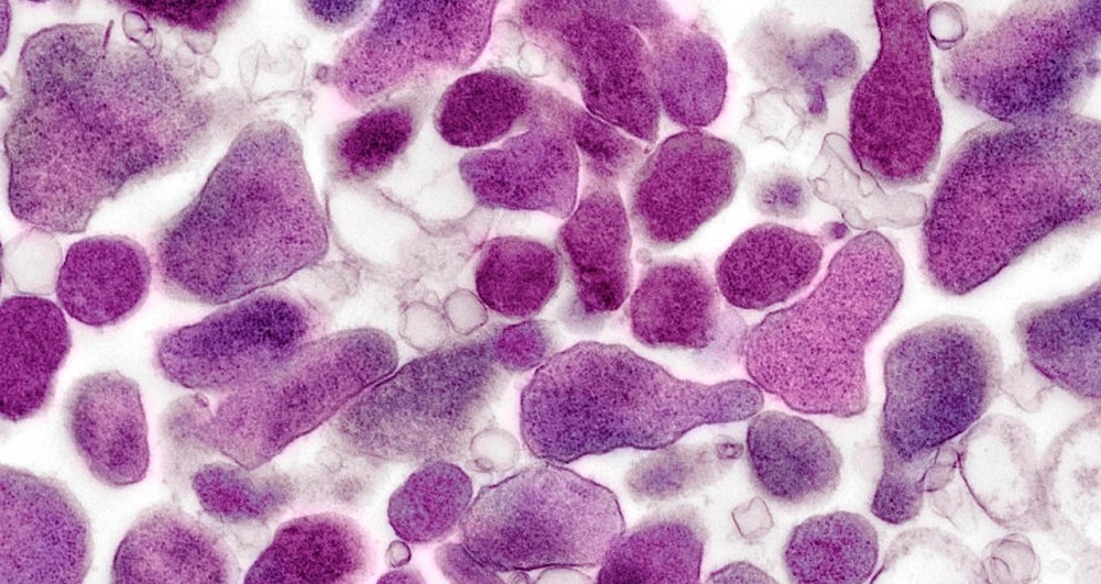 Mycoplasma genitalium: síntomas, causas y tratamiento de esta ETS