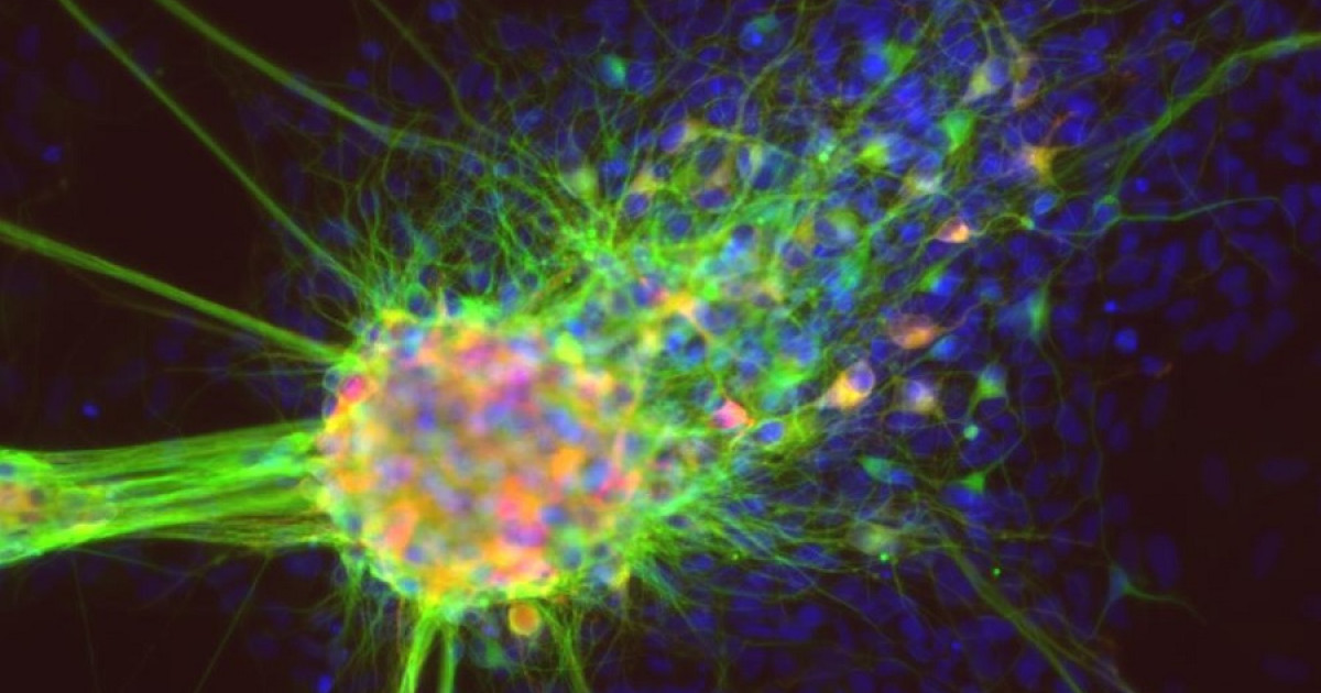 Tiramina: características de este neurotransmisor de tipo monoamina