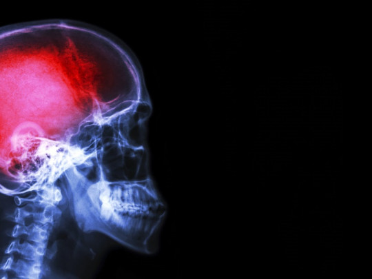 Los 13 tipos de dolor: clasificación y características