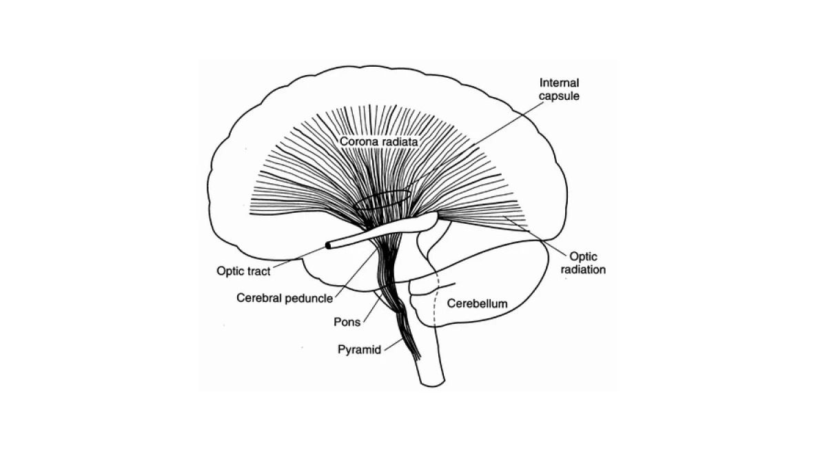 Anatomía De La Corona Radiata Intrahemispheric Association Fibers Of