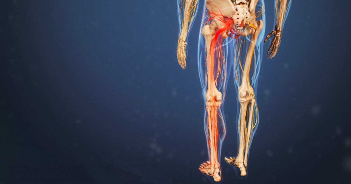 Nervio isquiático (ciático): anatomía, funciones y patologías