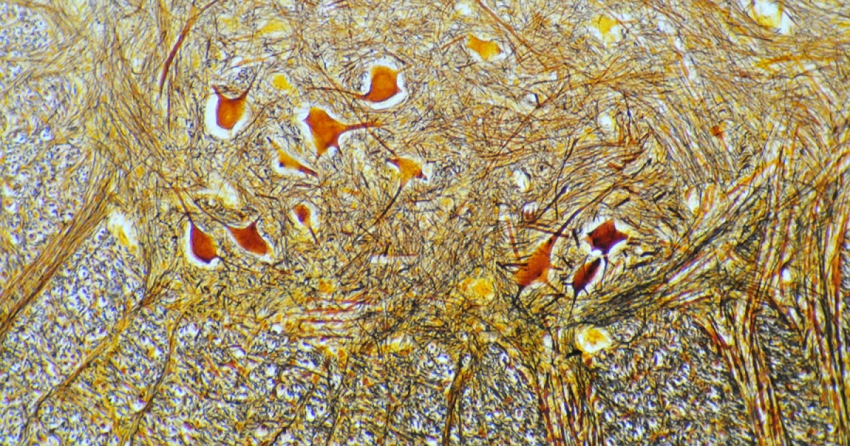 Psicobiología: ¿qué es y qué estudia esta ciencia?