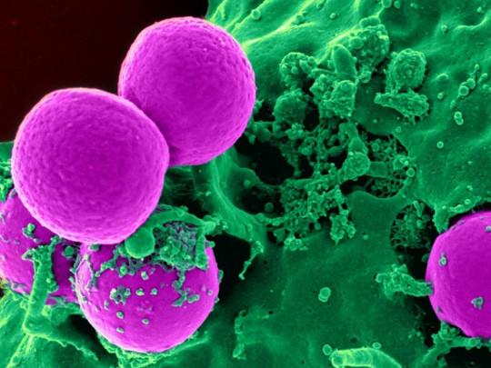 Células satélite: qué son, características y funcionamiento
