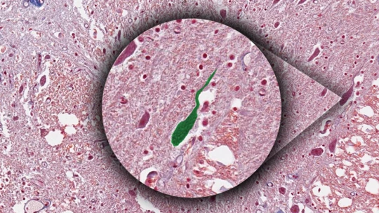 Neuronio Unipolar Sob Microscopio