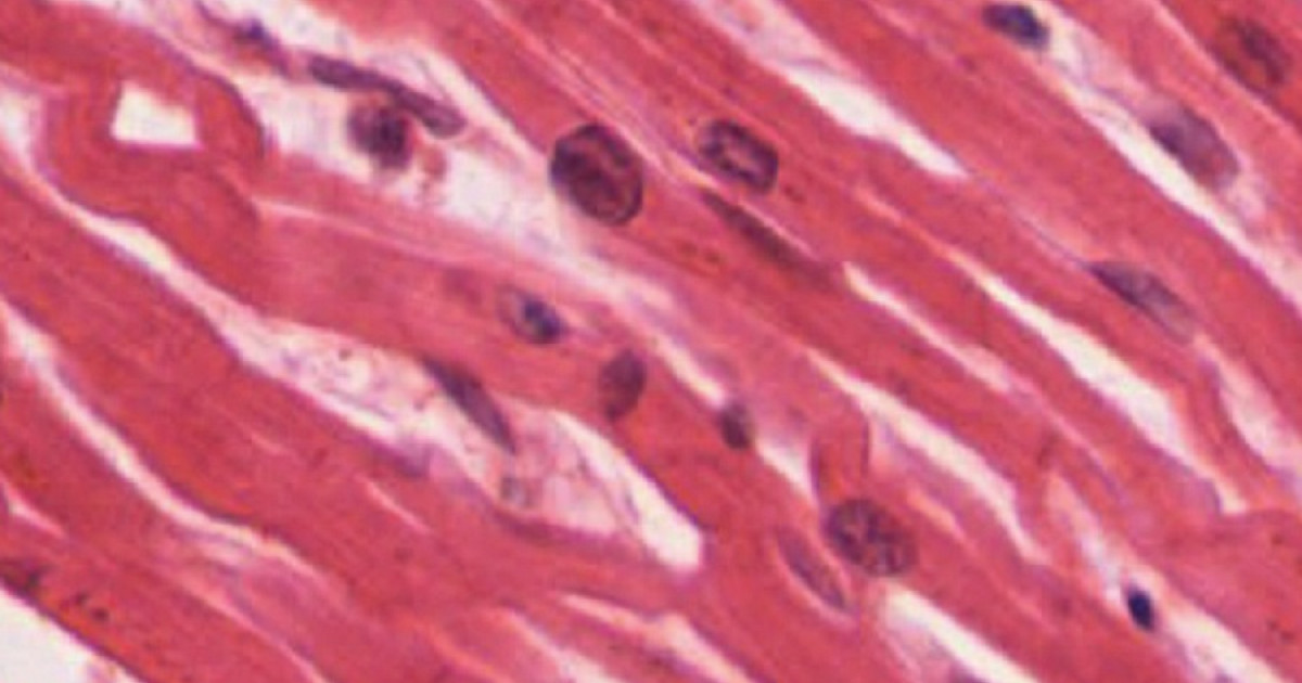Fibra muscular: qué es, partes y funciones