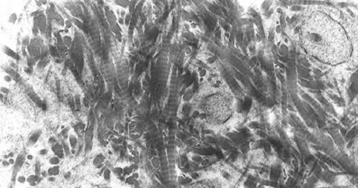 Matriz ósea: qué es, componentes y características