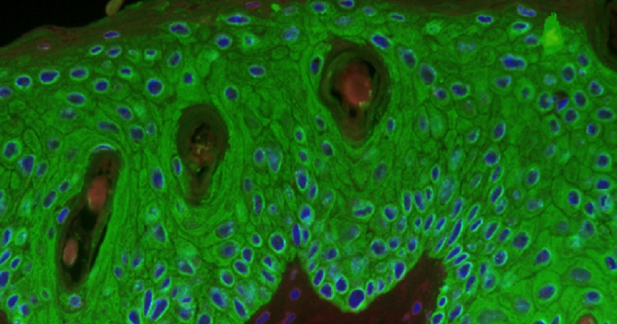 Queratinocitos: qué son, funciones y fases de desarrollo de estas células