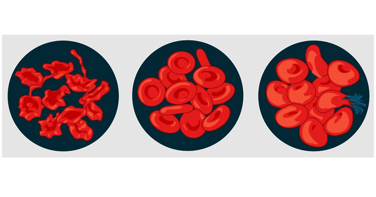 Citólisis: qué es, cómo afecta a la célula y enfermedades asociadas