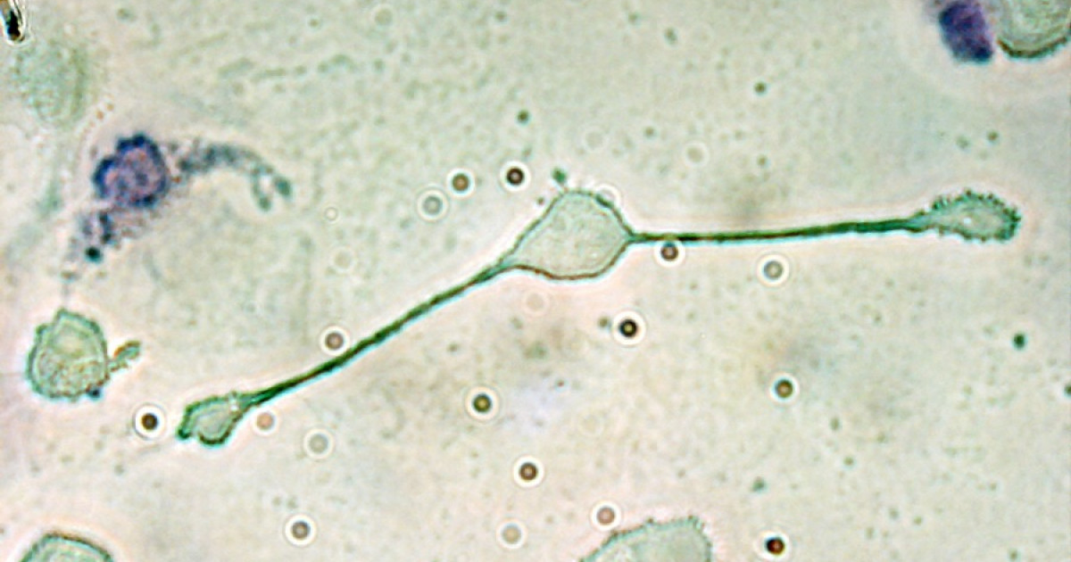 Macrófagos: qué son, características y funciones