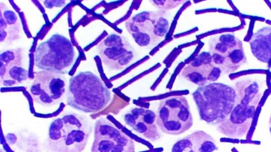 Canal Ru Ingenioso Caracteristicas De Las Eubacterias Y Arqueobacterias